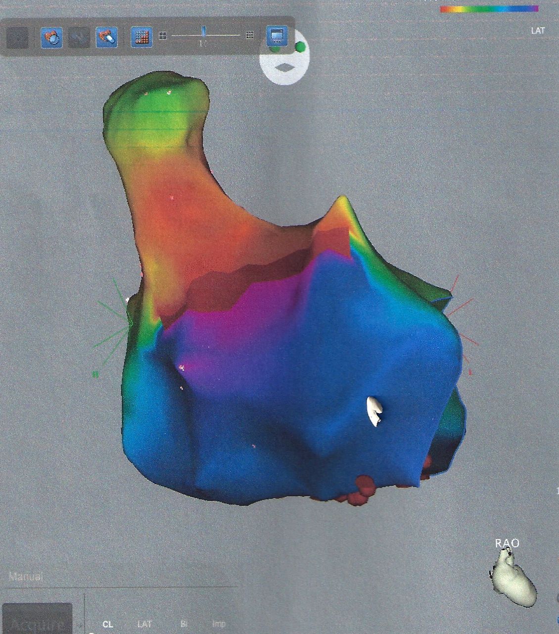 Crumbs From The Toaster: Atrial flutter in the human heart