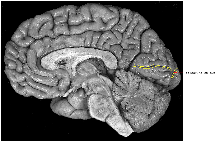 Atlas de neuroanatomía: FISURAS, SURCOS Y GIROS