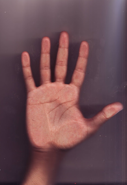 Loss Of Left Hand In Accident Indian Palmistry ~ INDIAN PALM READING ...