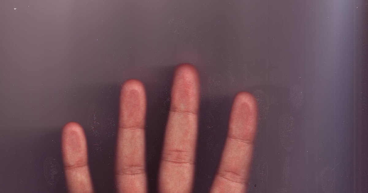 Loss Of Left Hand In Accident Indian Palmistry ~ INDIAN PALMISTRY ...