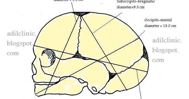 Fetal Skull Diameters, Diameter Of Skull Of Fetus at Time Of Delivery,
