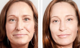 Strengthen Face Skin And Jowls Using Facial Aerobics