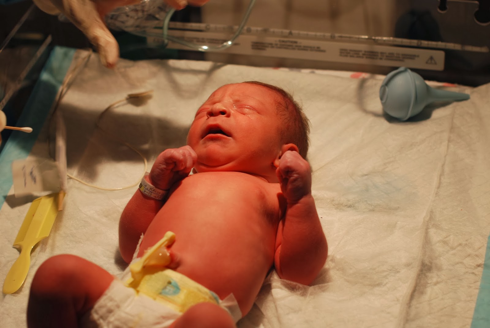 Life After Perinatal Stroke: Adam's Story: A little history...