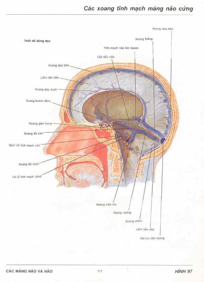 Các xoang tĩnh mạch sọ nhóm sau trên - Tài liệu ôn thi Bác sĩ nội trú ...