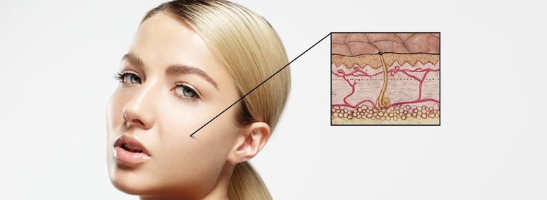 ¿Qué son las Enfermedades cutaneas?