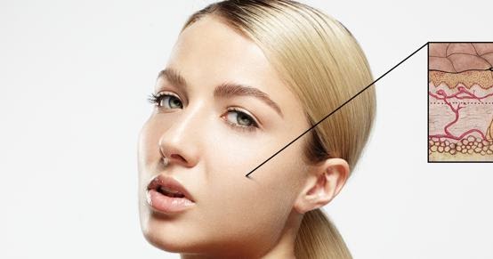 ¿Qué son las Enfermedades cutaneas?