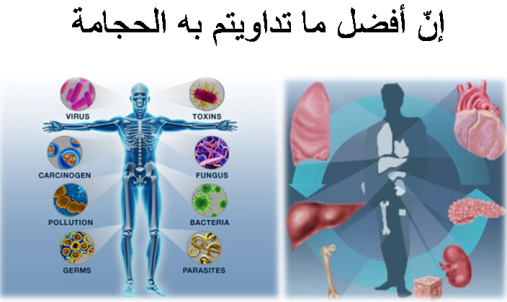 AL HIJAMA AL SUNNAH