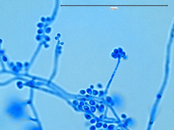 Fun With Microbiology (What's Buggin' You?): Sporothrix schenckii ...