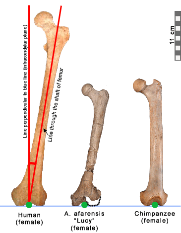 The 'Scope: Our Bodies Were Not Built To Last