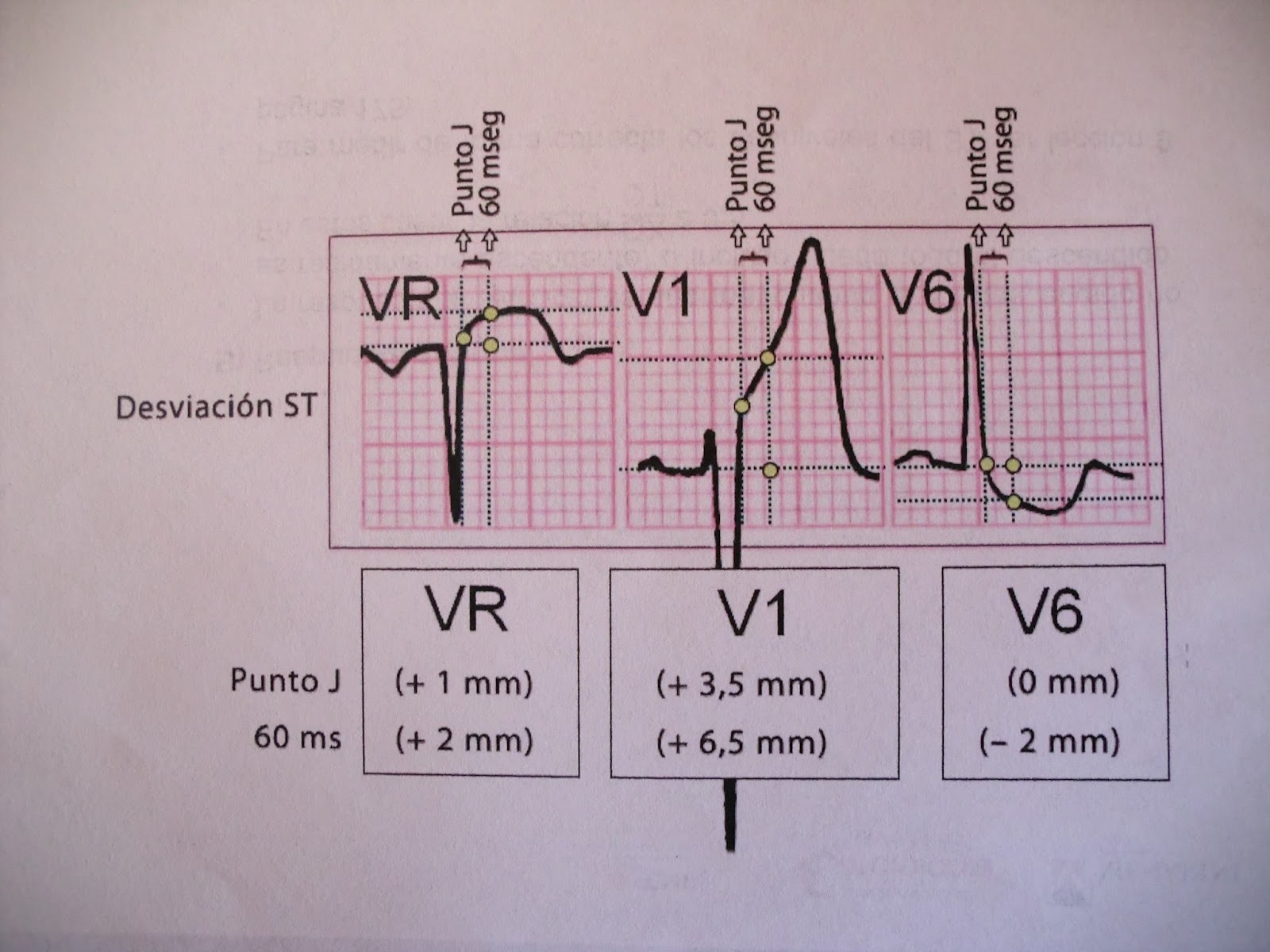 EDUARDO MILL FERREYRA.: Electrocardiografía. Interpretación del ECG normal.