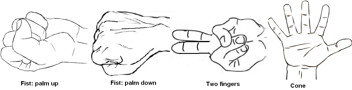 शशांक परुळेकर: Hand Position: Correction of Uterine Inversion