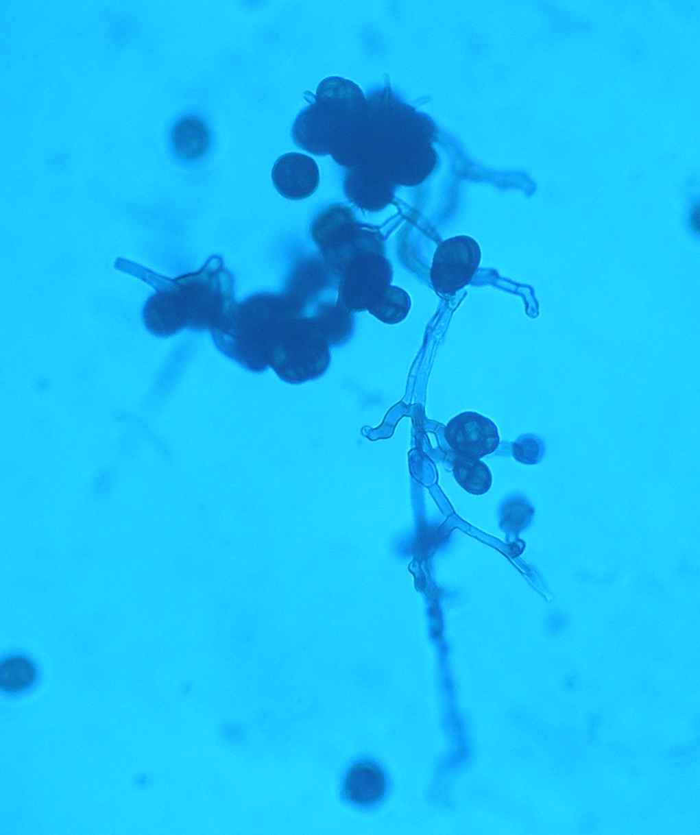 ATLAS MICOLOGIA: STEMPHYLIUM