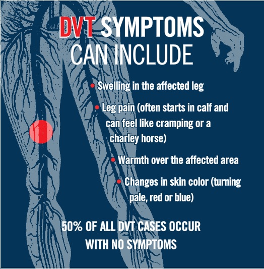 Be aware of DVT and travel safely this summer ~ @VHC