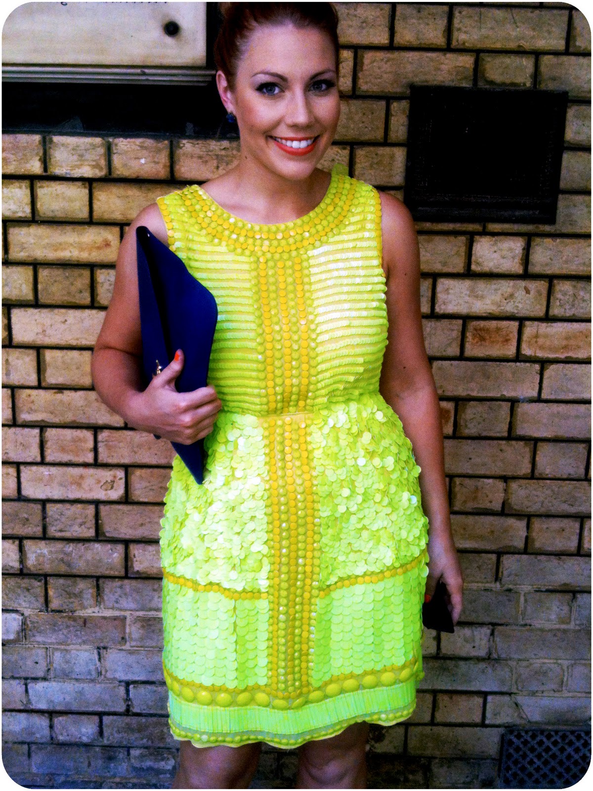 artsnoob-ing: fluro dress