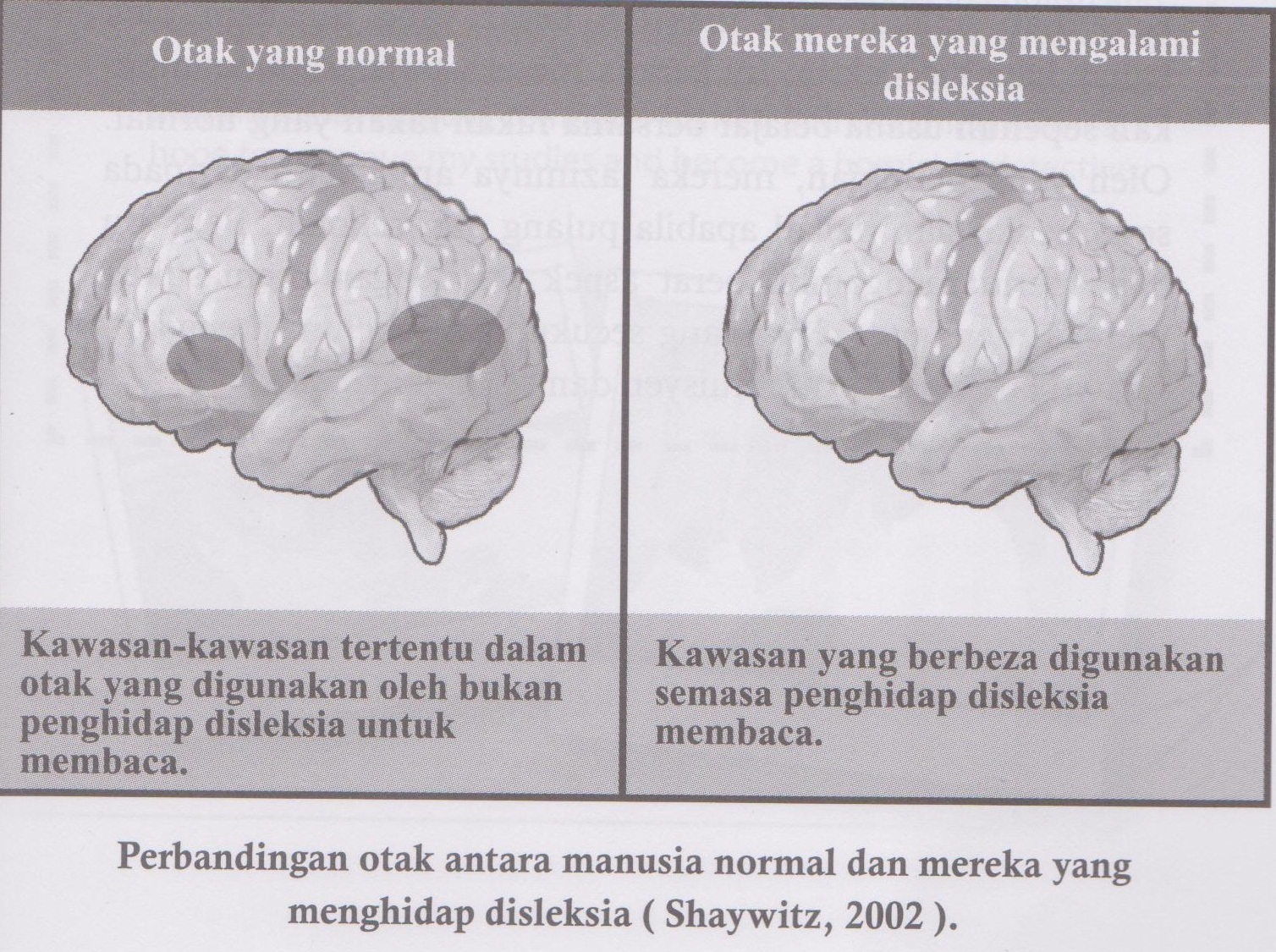 Ding Dang : Disleksia dan otak kita (part 2)