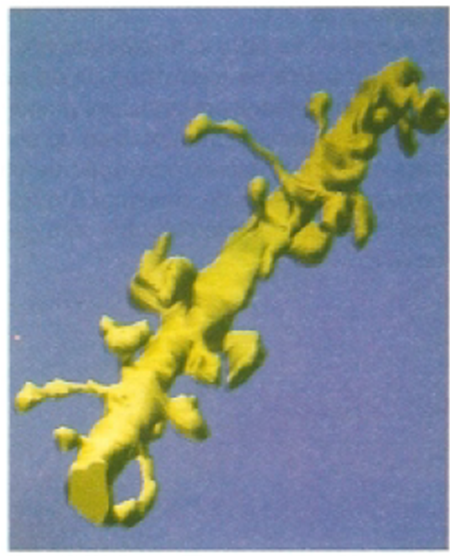 Med Questões: Neurônios e Glia (Bear - Cap. 2)