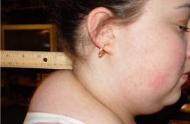 Migraines No More! Self Care Guide for Migraines, TMJ, and Scoliosis ...