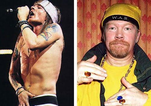 ROCK PASIÓN Y ESTILO: Axl Rose antes y Después de la cirugía