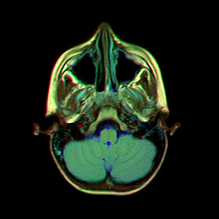 Nevit's blog: Color MRI of the Brain