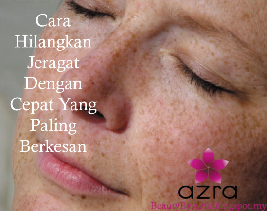 Cara Hilangkan Jeragat Dengan Cepat Yang Paling Berkesan - Beauty By Azra