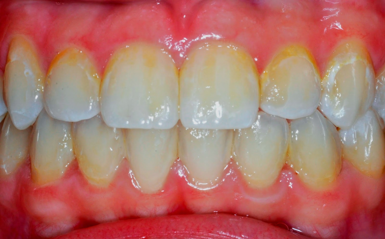 Dr Paul Leatham DMD: Tucson Dentist: August 2015