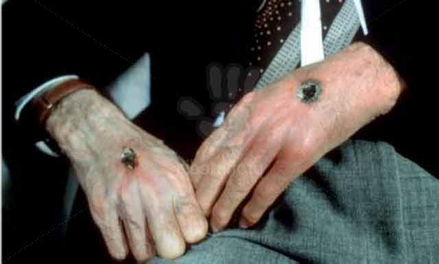 Misteri Keaslian Fenomena Stigmata, Luka Mirip Yesus - MITOS DUNIA