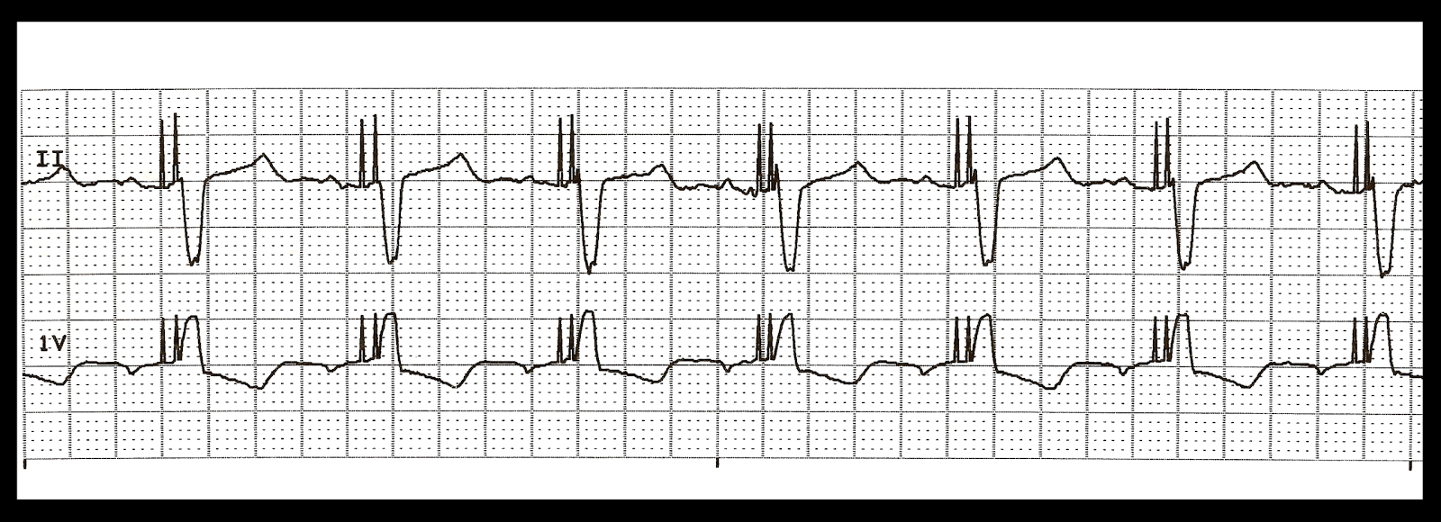 Practice Rhythm Strips 254