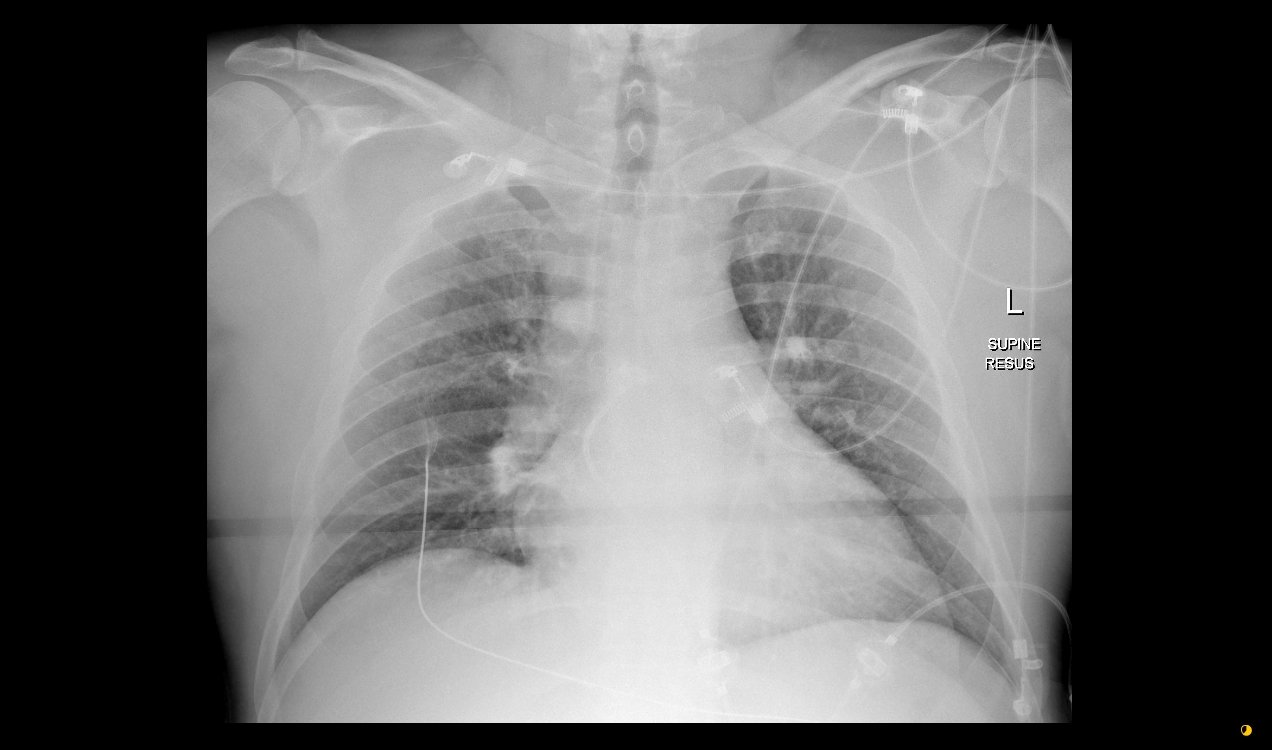 ECG of the Week: ECG of the Week - 8th July 2013 - Interpretation