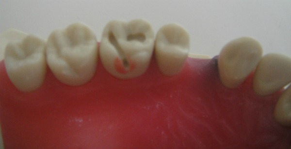 Stu-DENT Diaries: 06/01/2011 - 07/01/2011