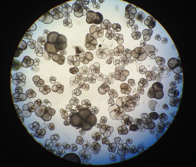 Microfossil of the Month - Globigerina Ooze