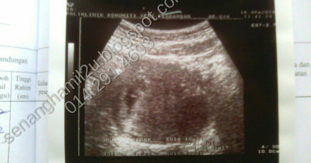 Senang Hamil: Hamil 2 Bulan - 1 DaraAyu
