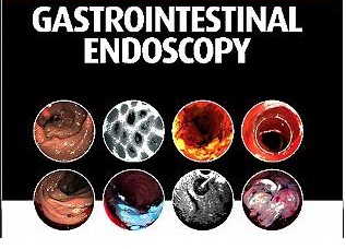 Advanced Gastrointestinal (GI) Interventional Endoscopy