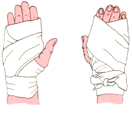 Yeleandri Quintero: Procedimientos de vendajes: