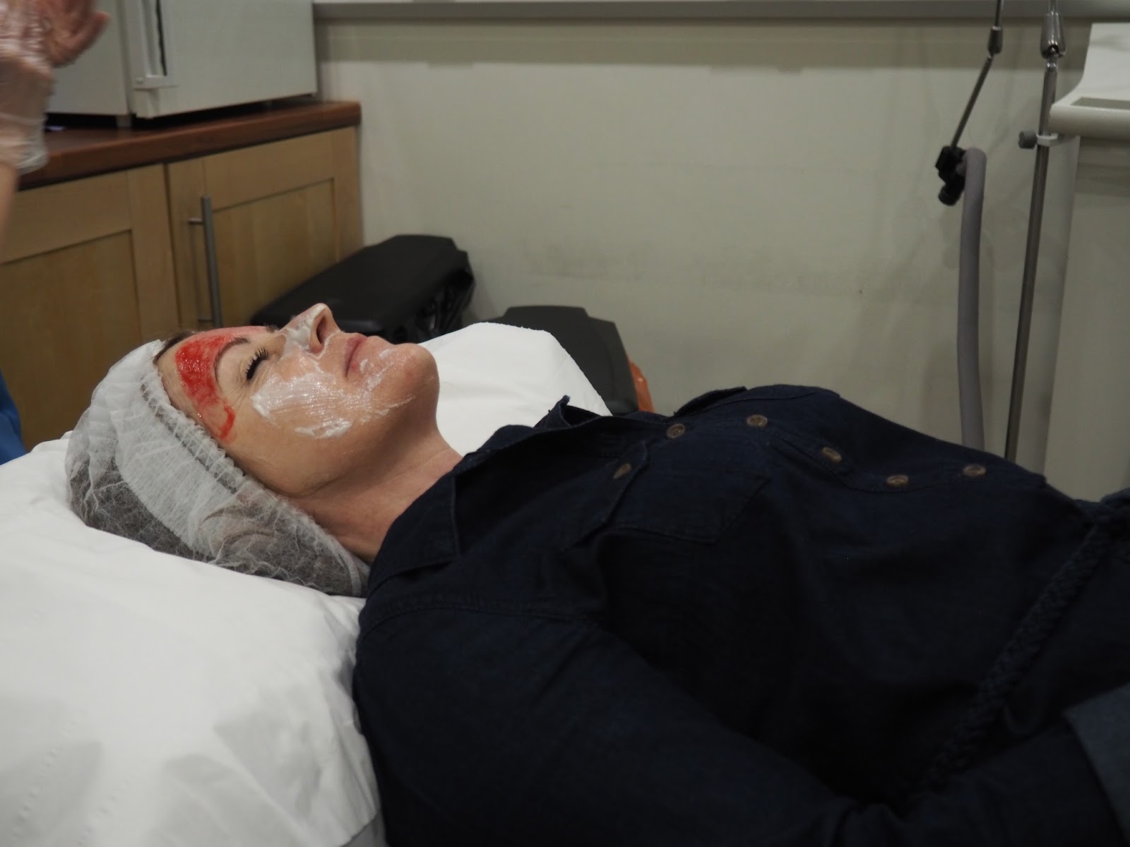 Collagen PIN || Medizen Clinic | Priceless Life Of Mine