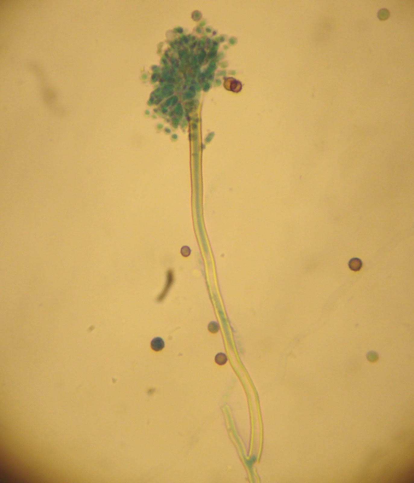Árvores e Fungos: [Fungos] Gênero: Aspergillus