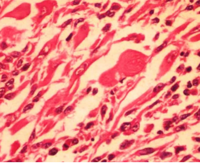 PATOLOGÍA BUCAL: Patología General "Lesión y adaptación celular"