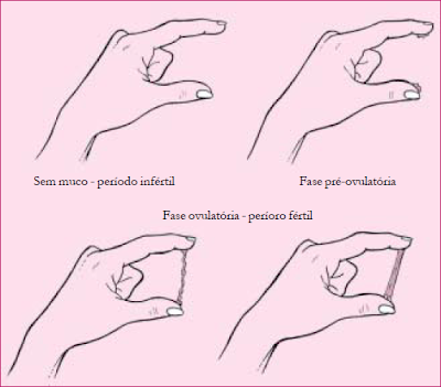 Métodos Contracetivos: Método de ovulação Billings ou Muco Cervical