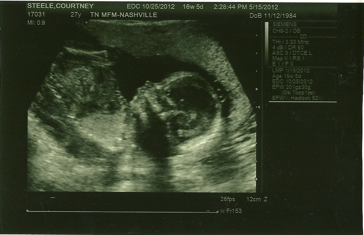 The Steeles: Baby: 17 weeks