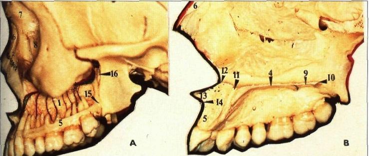 Dentistry lectures for MFDS/MJDF/NBDE/ORE: Note on Radiographic Anatomy ...