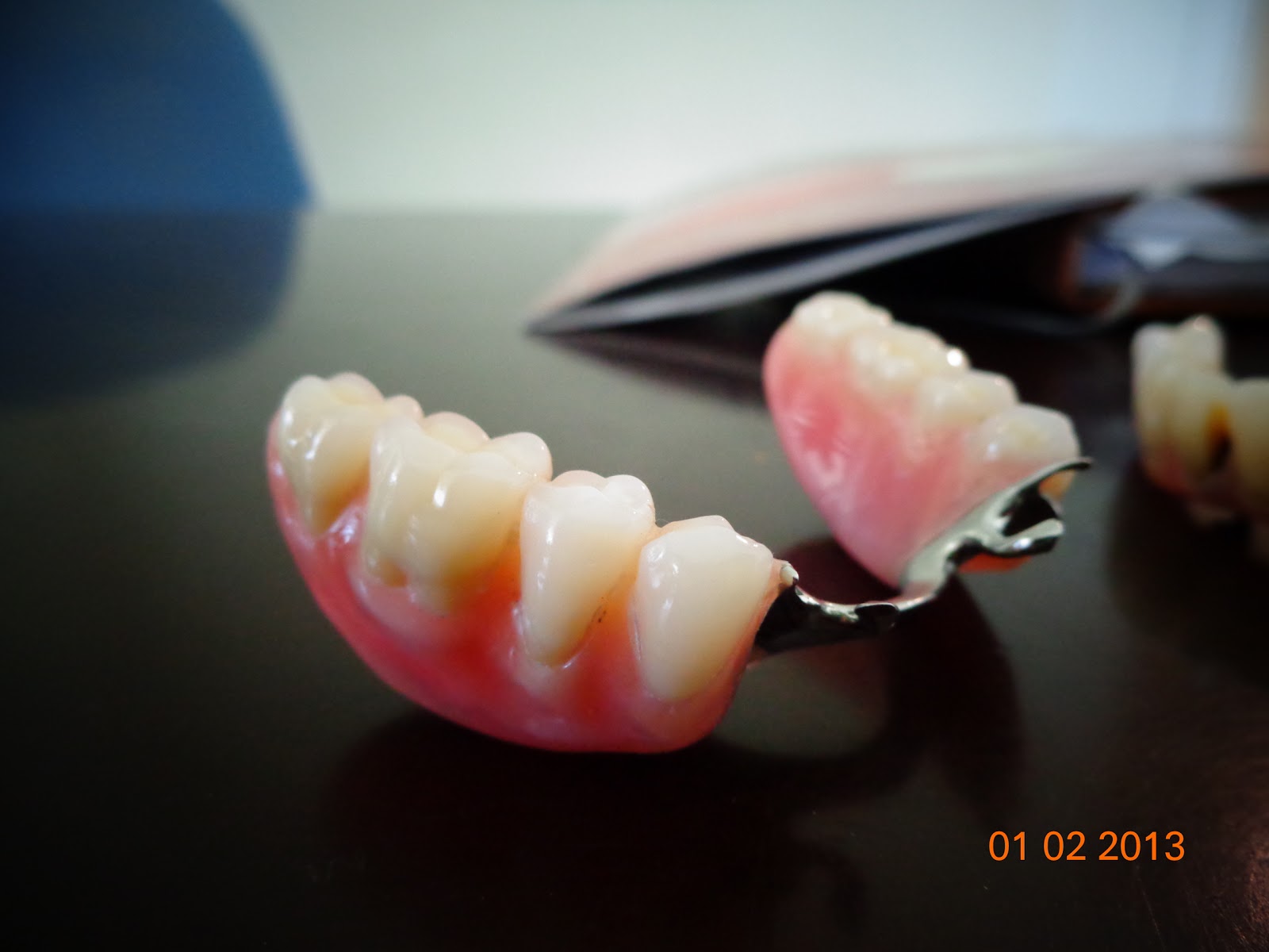 Ppr Superior Com Grampo - RETOEDU