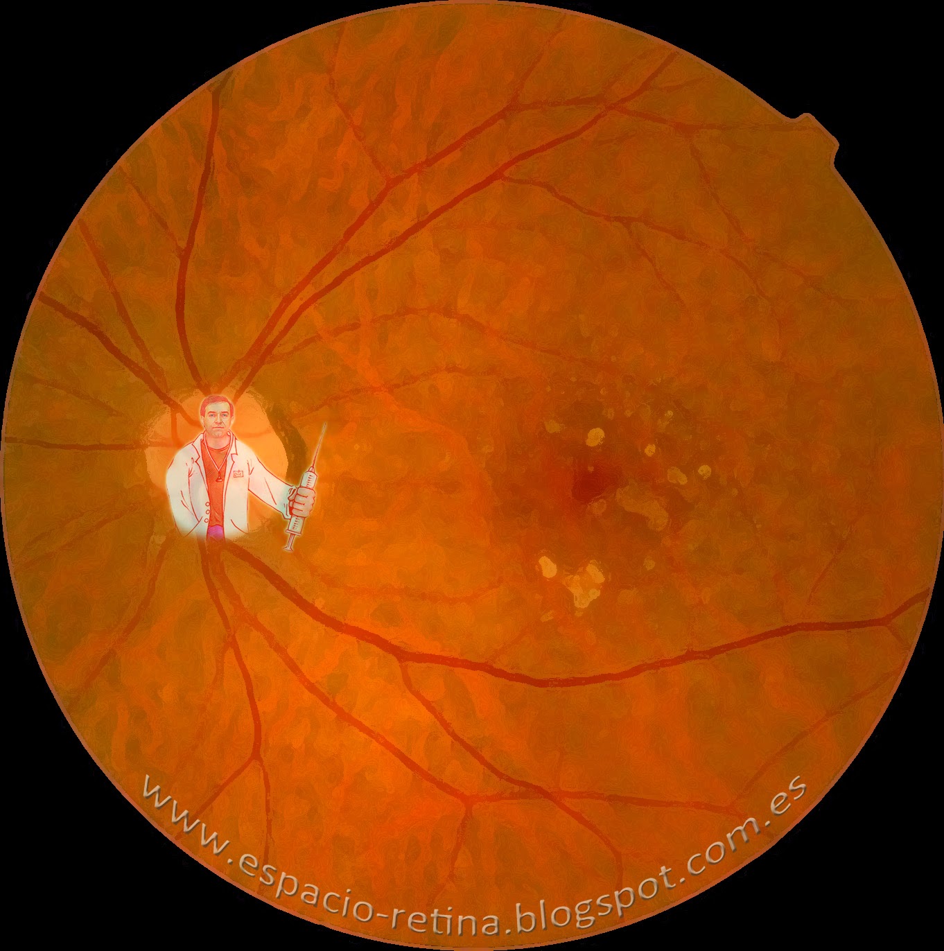 ZONA DE SALUD DE OFRA: ESPACIO RETINA: Descárgate el PDF presentación ...