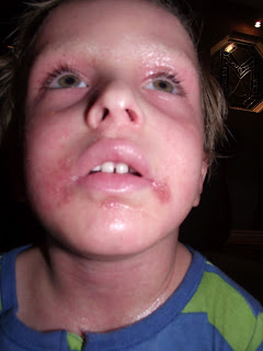 Green and Bitchy: manuka honey for preventing and clearing up skin ...