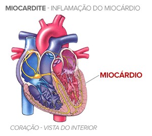 Fisiologia Fantástica: Coração Inflamado