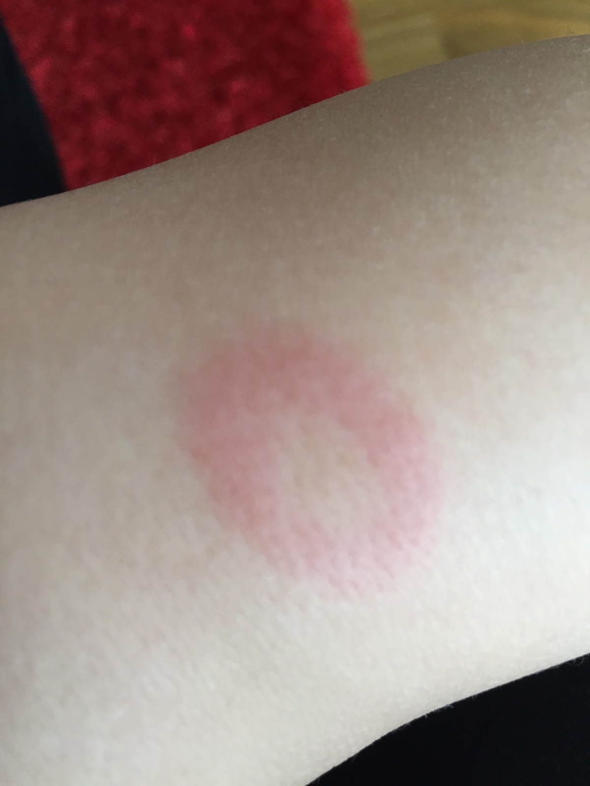 Livet med Sanna och Emma: Ringorm