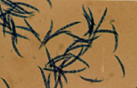 Microbiología y Epidemiología: Fusarium sp.