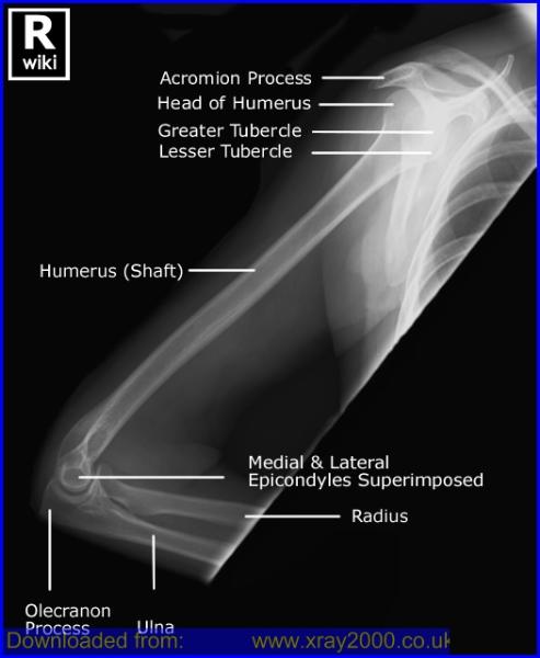 Radiographic positioning: Humerus AP and lateral