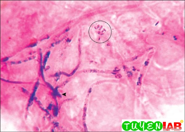 Staining Procedure for Rapid Identification of Fungi | Free Medical Atlas