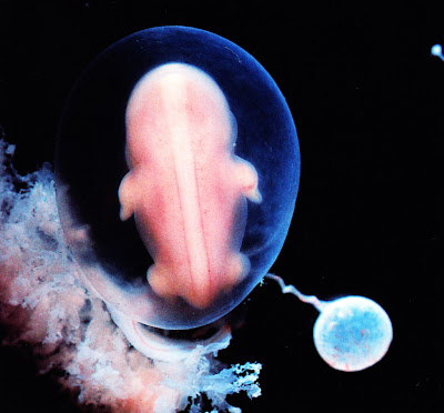 Discovering Something New -- ongoing learning: Human embryo at 6 weeks ...