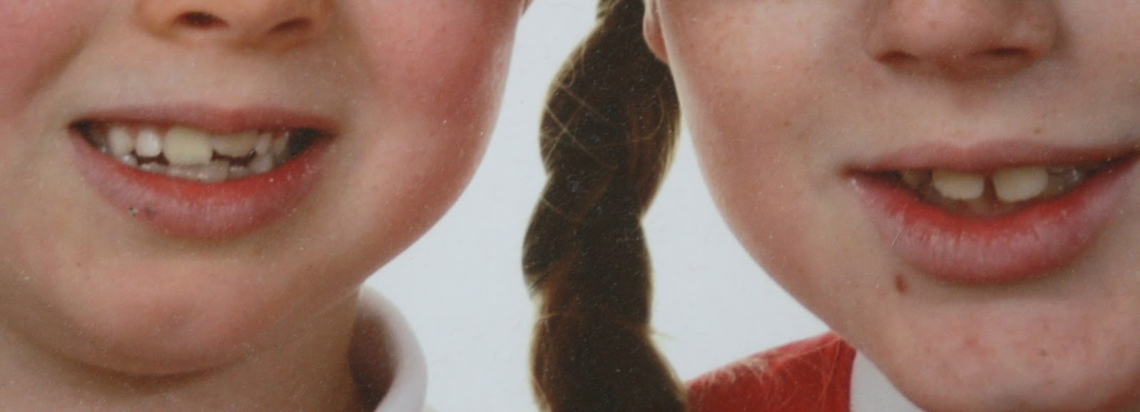 Gappy teeth - Mum of Three World