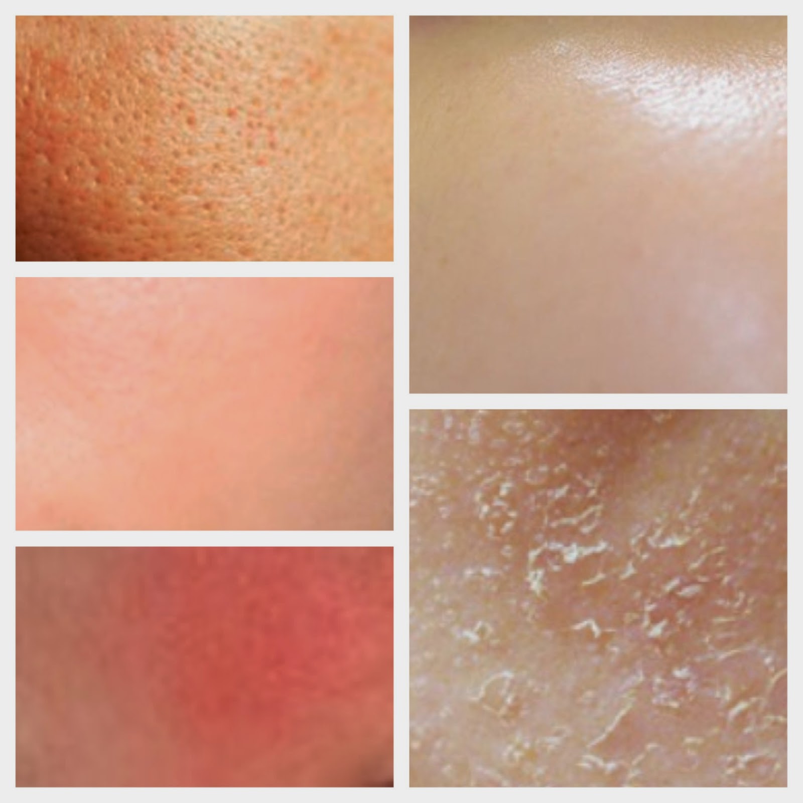 AestheticianBeauty: Know Your Skin Type